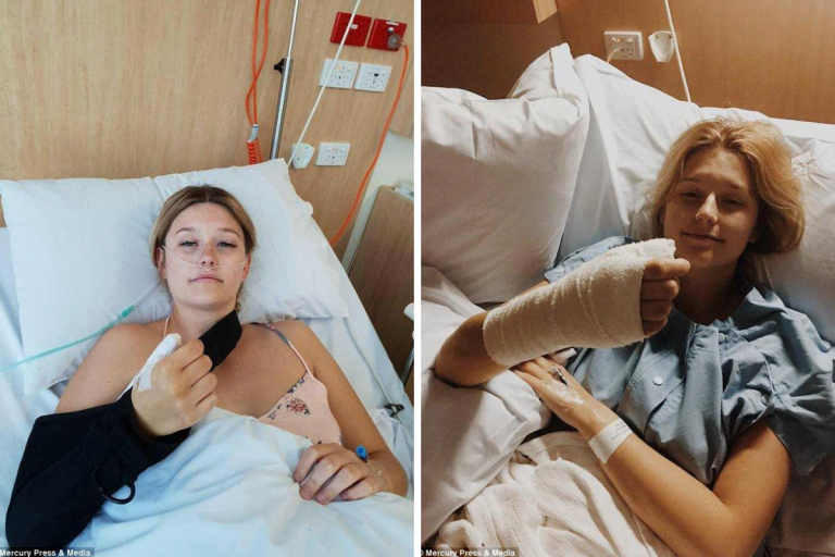 Girl Developed Skin Cancer After Her Nail Biting Habit